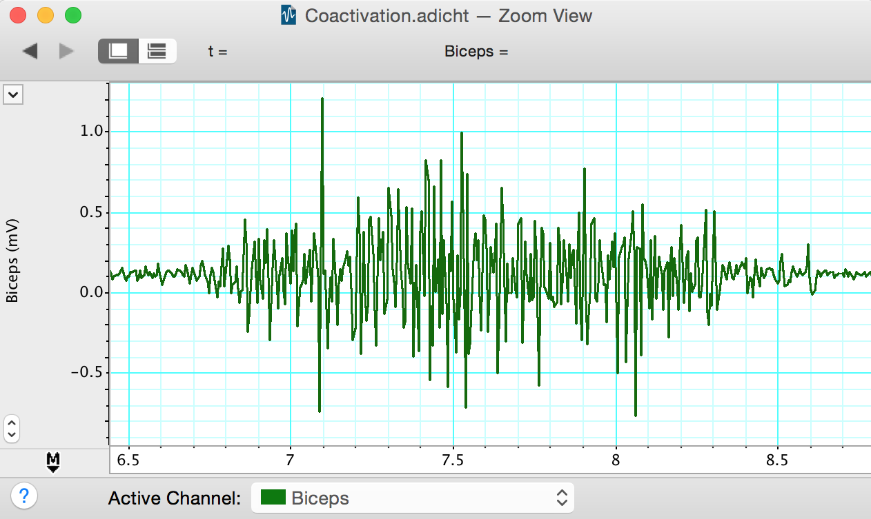 ZOOL430/430L Animal Physiology and Laboratory - Lab 8: Human ...